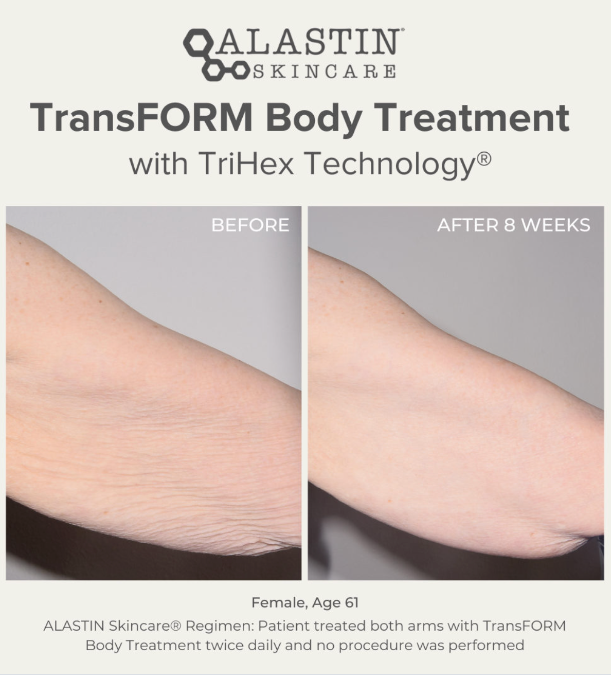TransFORM Body Complex 170g – The Clinic